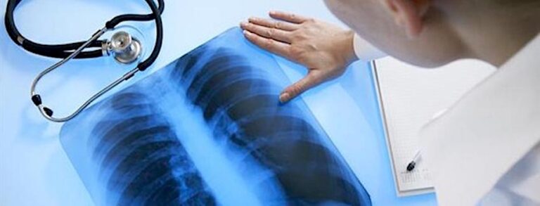 Pas på dine lunger - læs hvilke sygdomme der påvirker dem - Infosundhed.dk